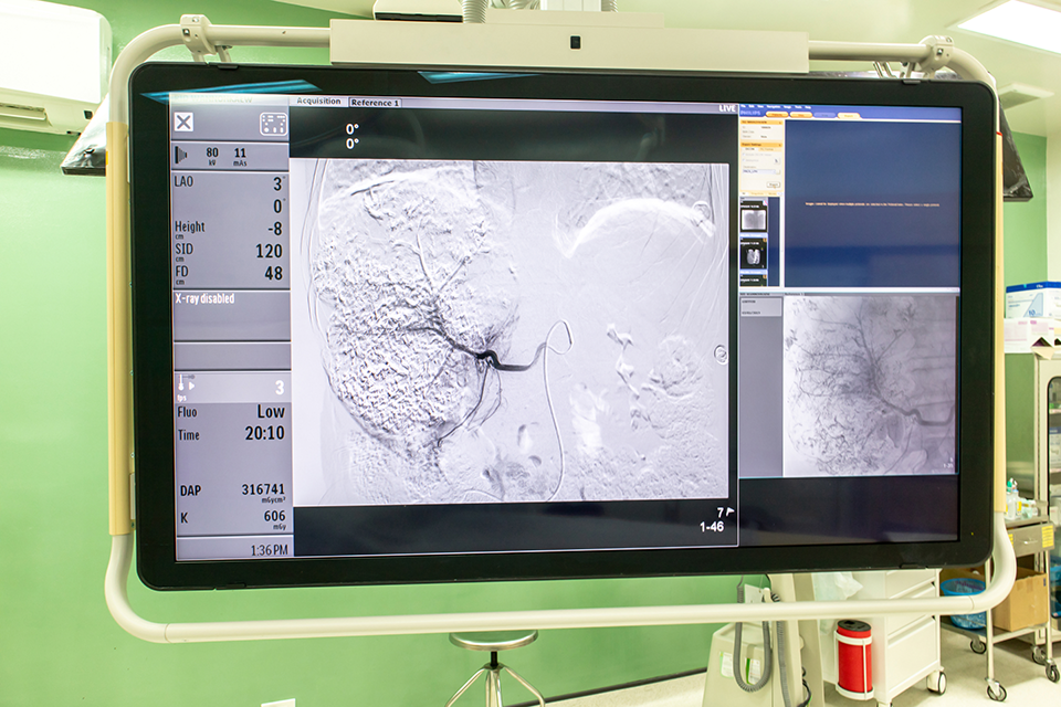Optimizing Hybrid Operating Rooms for the Patient, Part 1: Introduction ...