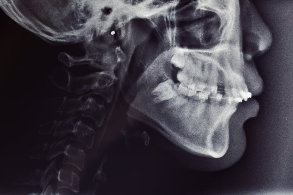 How Auto-Traction Straps Can Improve Diagnostic Accuracy in Cervical ...