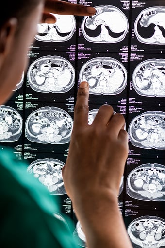 Optimal Patient Positioning in Radiology: Ensuring Accurate Diagnostics